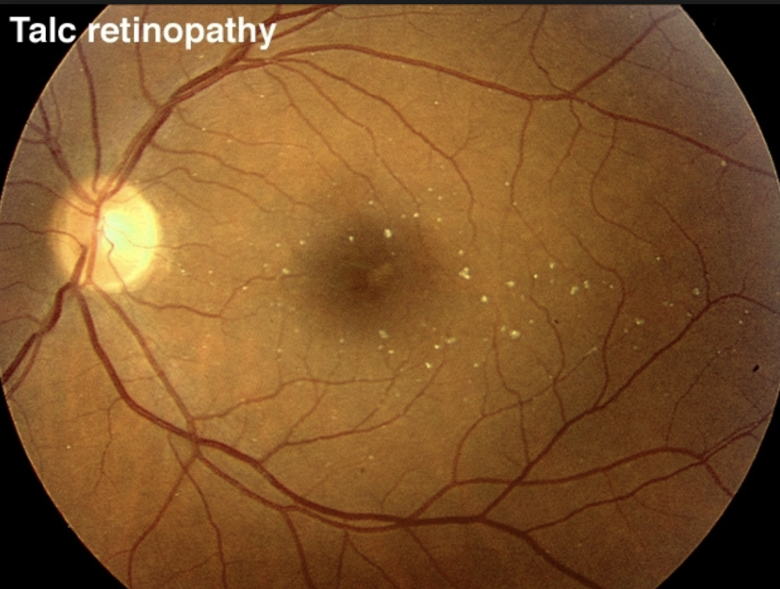 25 Ways Optometry School and Grey's Anatomy are the Same and Different